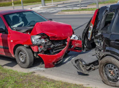 Amputation After Car Accidents in Ventura: What Can You Do When Another ...